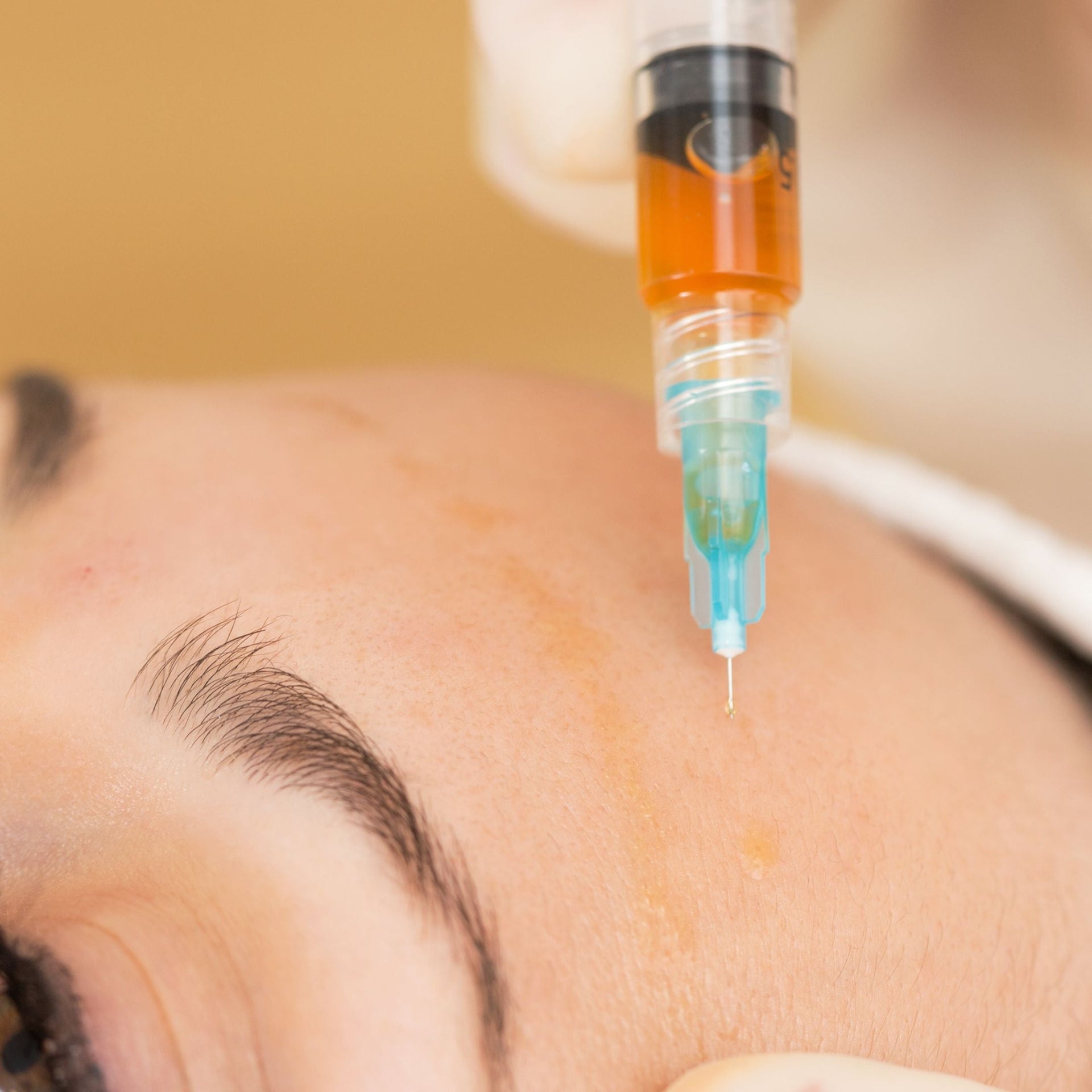 FeelSoft™ Meso Needles – AVADERM®